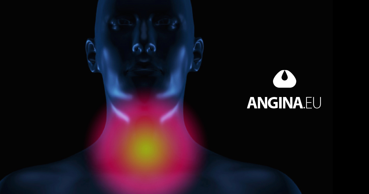 Příznaky a druhy Angíny | Angina.cz